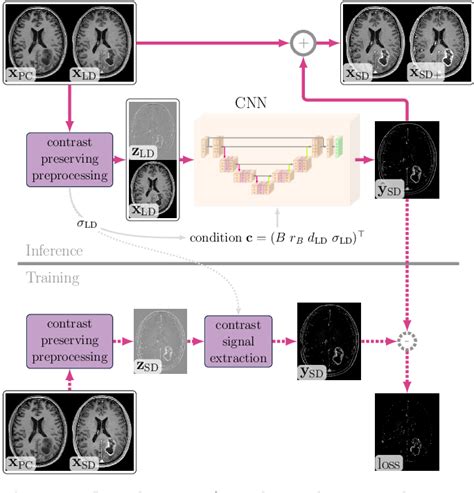 Figure 1 From Gadolinium Dose Reduction For Brain Mri Using Conditional Deep Learning Semantic