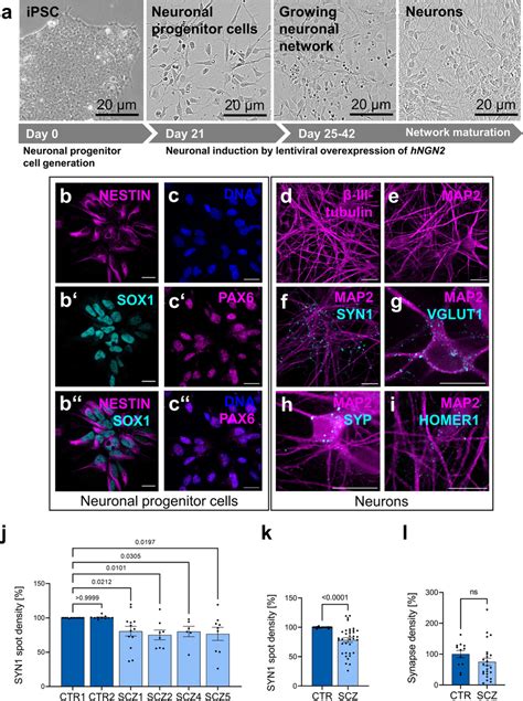 Presynaptic Marker Density Is Significantly Reduced In Neuronal