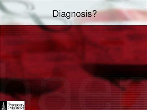 Ppt Bilateral Leg Swelling Powerpoint Presentation Free Download