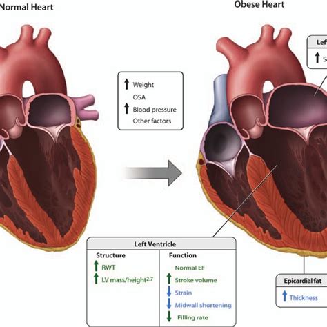 Composite Of Cardiac Structural And Functional Abnormalities In Obese