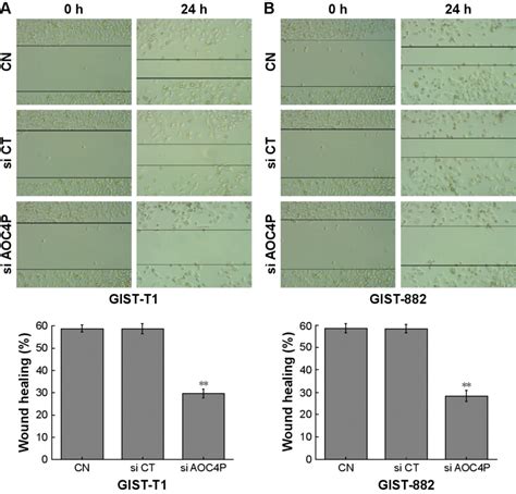 The Migration Ability Of Gist T1 And Gist 882 Cells In Cn Si Ct And