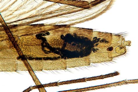 Mosquito Female Genitalia Photograph By Dr Keith Wheeler Science Photo Library Fine Art America