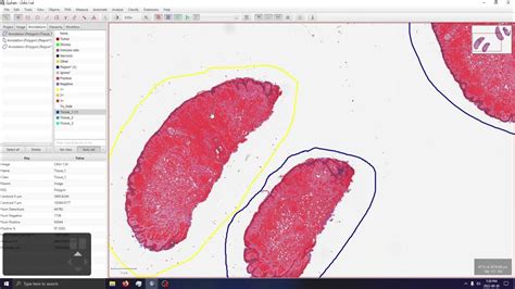 Multi Section Analysis In Qupath Youtube