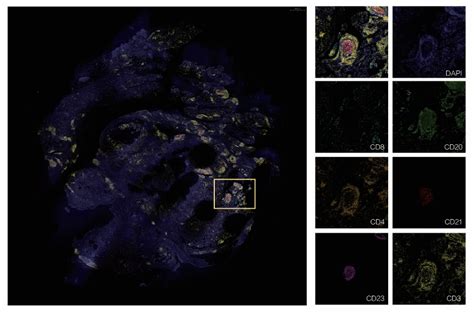 Magic Fluor™ Mihc Staining Kits Creative Diagnostics