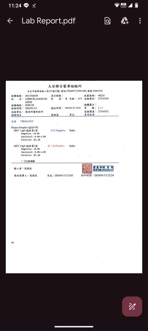 Anybody Know How To Get The Western Blot Test Rhsvfalsepositive