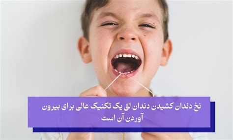 مهم‌ترین علت دیر افتادن دندان شیری در کودکان؛ راهنمایی ضروری برای