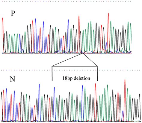 Allele Specific Rt‐pcr Sequence Obtained From Rt‐pcr Amplified Cdna