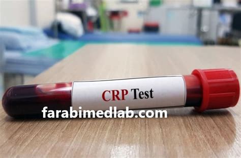 میزان نرمال آزمایش Crp Quantitative بهترین آزمایشگاه تخصصی تهران ️ آزمایشگاه فارابی