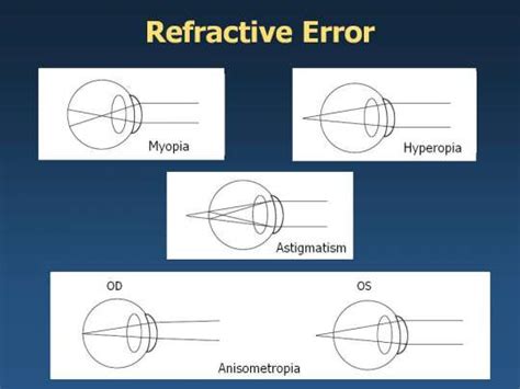 Uncorrected Refractive Errors Leading Cause Of Visual Impairment