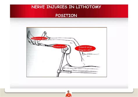 Patient Different Position Under Anesthesia Pptx