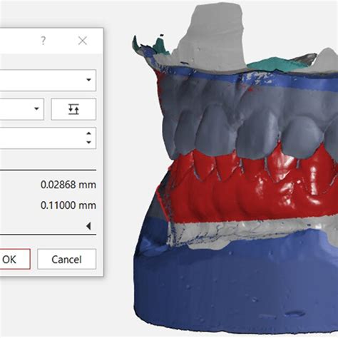 Best Fit Surface Feature Based Registration Download Scientific Diagram