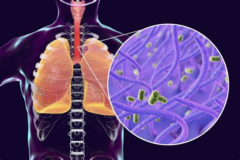 Bacteria Bordetella Pertussis The Causative Agent Of Whooping Cough
