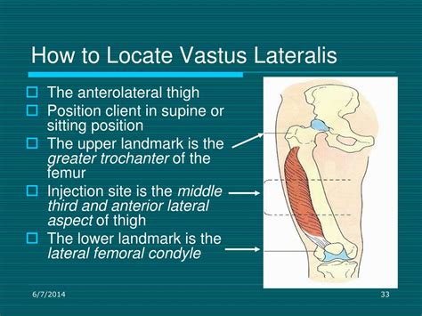 Ppt Massachusetts Department Of Public Health Training Module