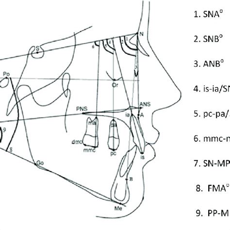 Sagittal And Vertical Dental Linear Measurements Sagittal Dental