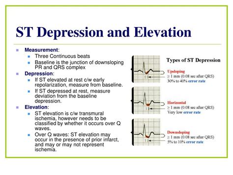 St Depression Vs St Elevation At Rebecca Skinner Blog