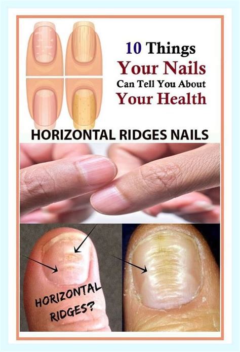 8 Important Signs Tongue Health Health Health Tips