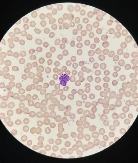 Basophil Grown By Me 100x R Microscopy