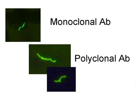 Morgellons Book Morgellons Specialist Dr Ginger Savely