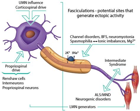 Fasciculations Upper Or Lower Motor Neuron