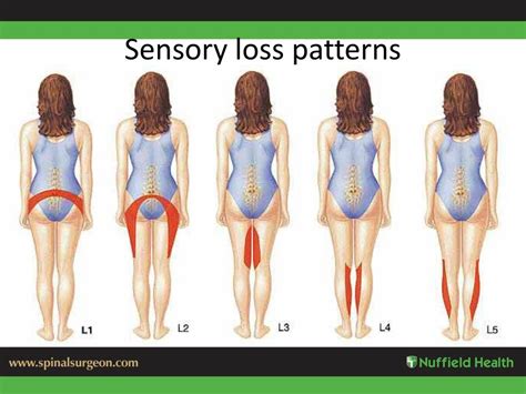 Ppt Sciatica Differential Diagnosis Powerpoint Presentation Free Download Id 2368999