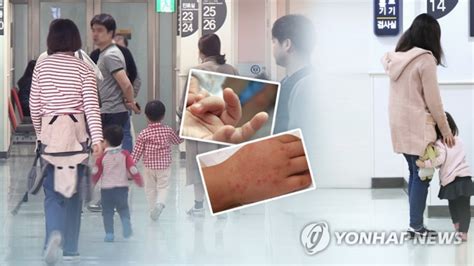 БНСУ Нярайн гар хөл амны халдварт тууралт сүүлийн 10 жилд байгаагүйгээр өслөө Мэдээ