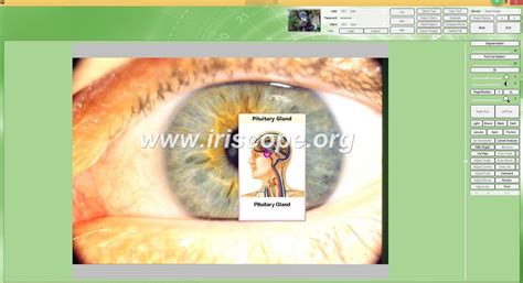 What Is Iriscope Iridology Camera Maikong Iridology Pictures And
