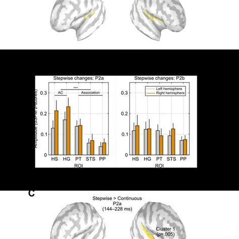 Source Analysis Of The P2 Subcomponents A Cortical Generators Of The