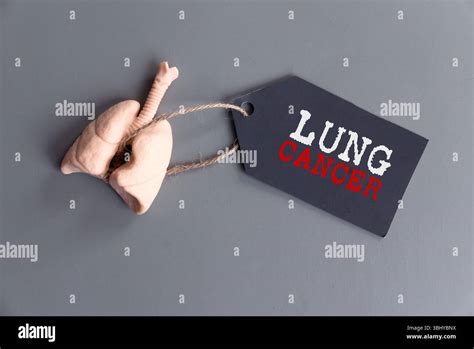 Lung Cancer Awareness Concept With Anatomical Lung Model And Tag Stock