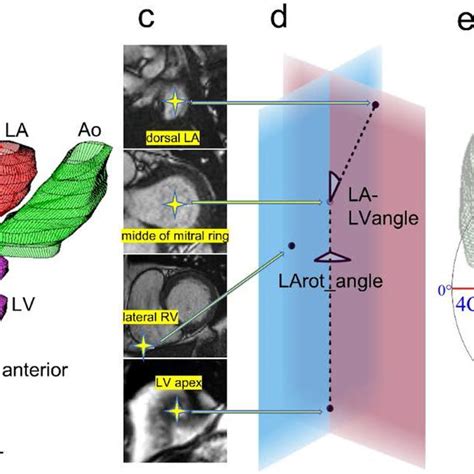 A Segmentation Of Left Atrium La In Short Axis Sax Cine Images At Download Scientific