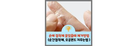 손에 접착제 묻었을 때 어떻게 하죠 손에 순간접착제 묻었을때 지우는법순간접착제 지우는 방법 오공본드 지우는 방법