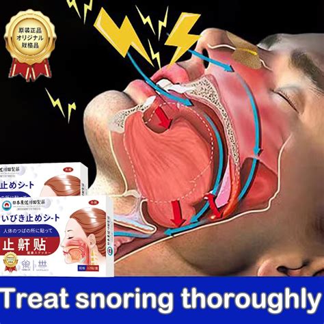 【in Stock】japan Anti Snoring Patch 12pcbox Stop Snore Solutions Snore
