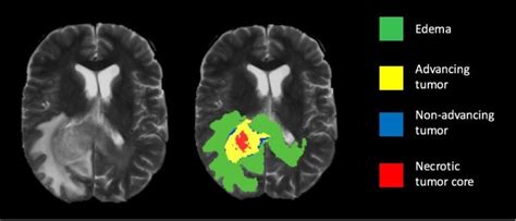 Image Segmentation With Machine Learning DataFlair