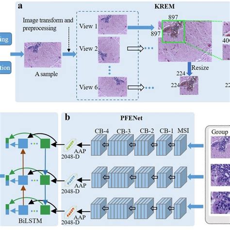 diagram of breast cancer pathological image classification using