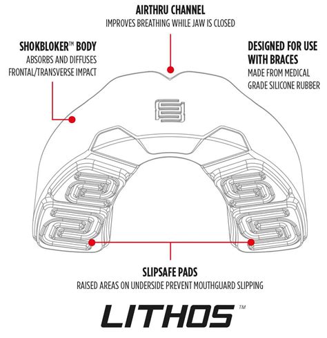 Braces Parts Diagram Understanding Key Components