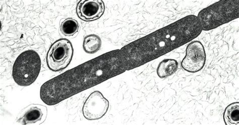 Cdc Anthrax Problem Head Of Bioterror Lab Reassigned Los Angeles Times