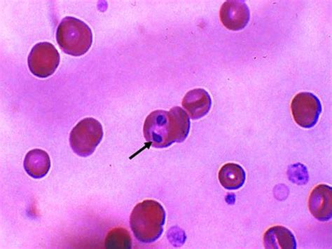 Babesia Spp Dbr