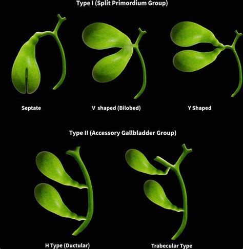 The Gallbladder And Extrahepatic Biliary Tract Anatomy And Variations Intechopen