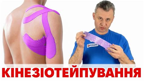 Кінезіотейпування - для чого потрібно, чим корисно. - YouTube