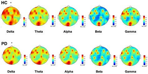Phase Locking Value Plv Connectivity Topoplot And Comparison Between Download Scientific