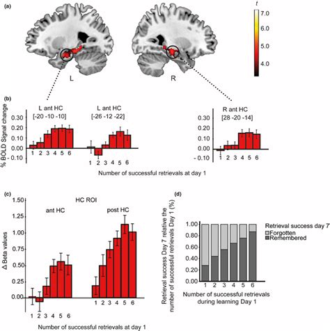 Ad Linear Parametric Modulation Effects From The Whole‐brain