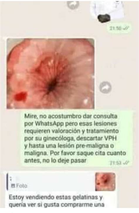 Ud Disculpe R Memexico