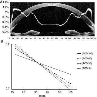 Differences In ACD At Points Between Males And Download Scientific Diagram