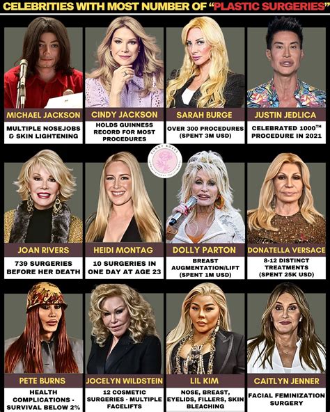 Viral 💉 Celebrities With The Most Number Of Plastic Surgeries