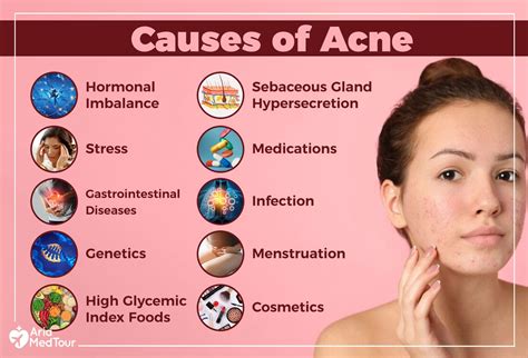 How To Get Rid Of Pimples On Face
