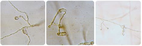 What Is Pythium — Pythium — Department Of Plant Pathology And