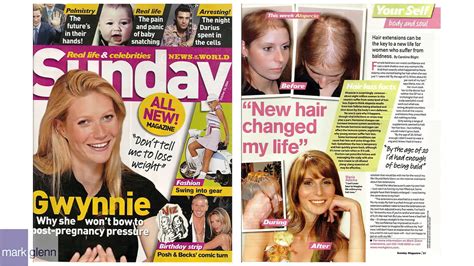 Female Hair Loss Before And After Hair Replacement Specialist Makeover