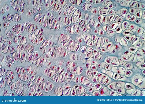 Human Hyaline Cartilage Bone Under Light Microscope View 41 Off