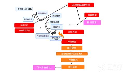 周围性面神经麻痹