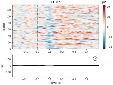 overview of meg eeg analysis with mne python — mne 1 11 0 dev23