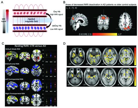 Fmri Imaging A Bold Effect In Mri B Areas Of Decreased Fmri